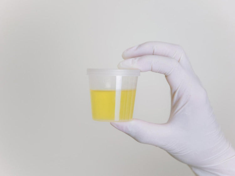 24-Hour Urine Collection. How To Do It Properly? – Ribbon Checkup